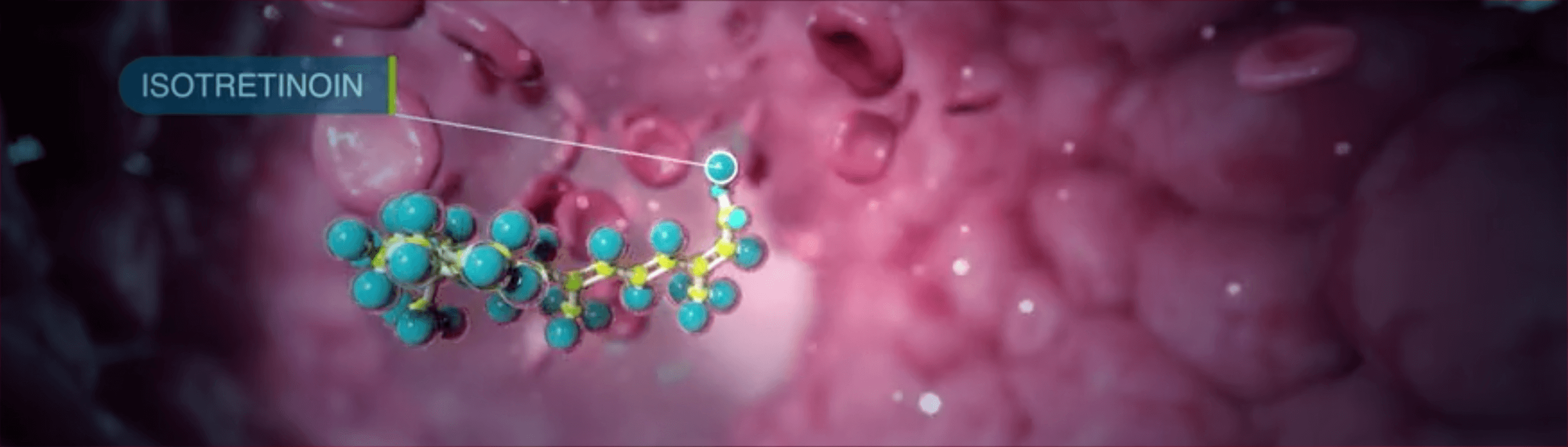 What is ABSORICA LD? | ABSORICA LD™ (isotretinoin)